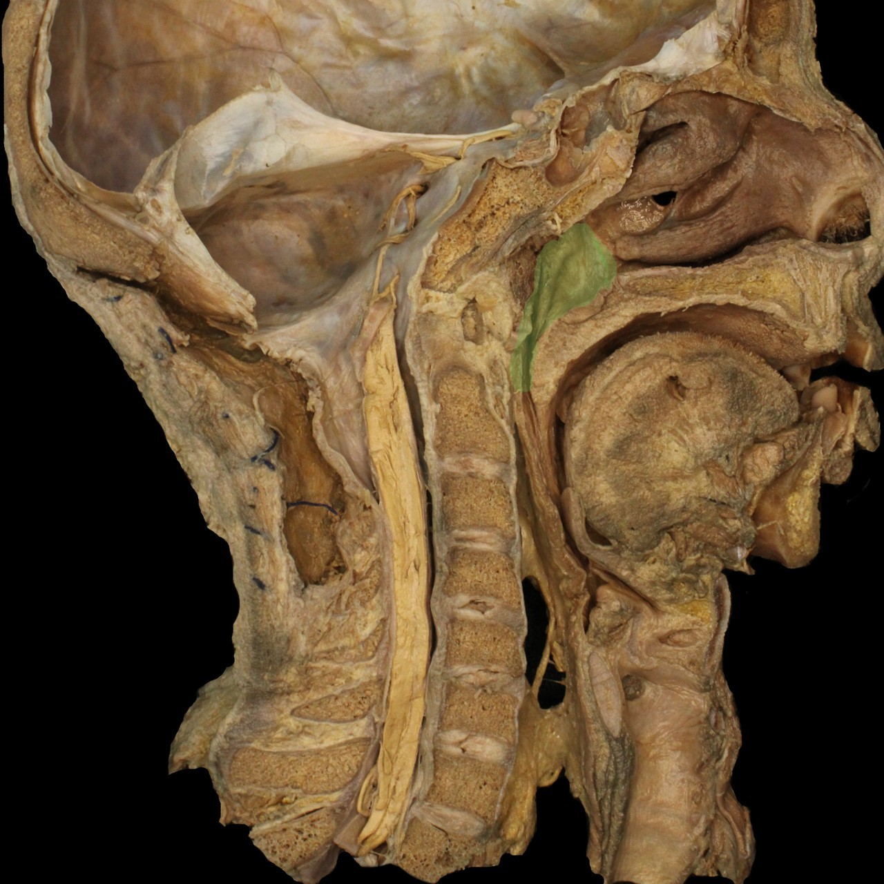 Anatomia Cabeça e Pescoço